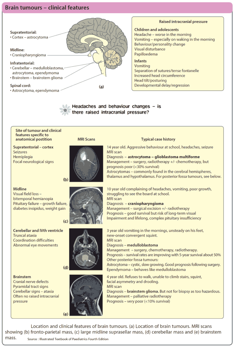 Headache Algorithm - Manual of Medicine