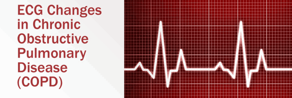 ECG Case 33 - Manual of Medicine