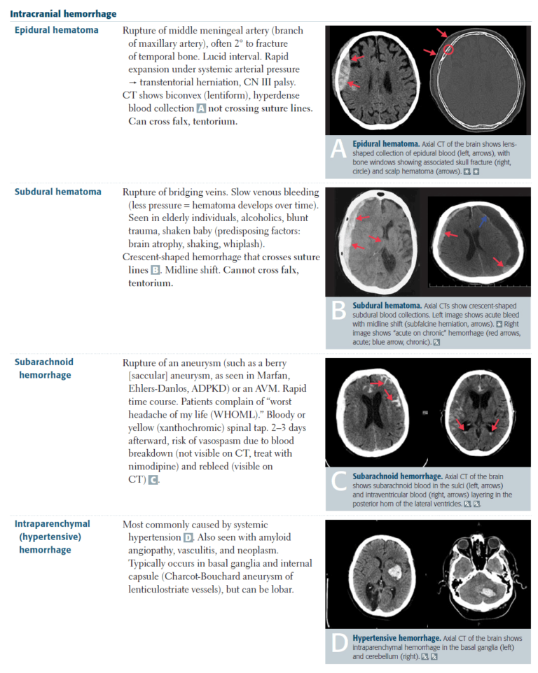 Headache Algorithm Manual Of Medicine