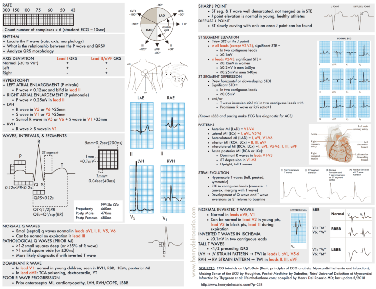 ECG Interpretation: All you need to know - Manual of Medicine