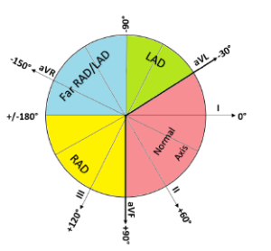 ECG Interpretation: All you need to know - Manual of Medicine