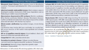 Heart Murmurs and Valvular Diseases - Differential Diagnosis ...