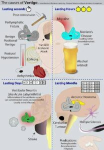Approach to the Patient with Vertigo and Dizziness - Manual of Medicine